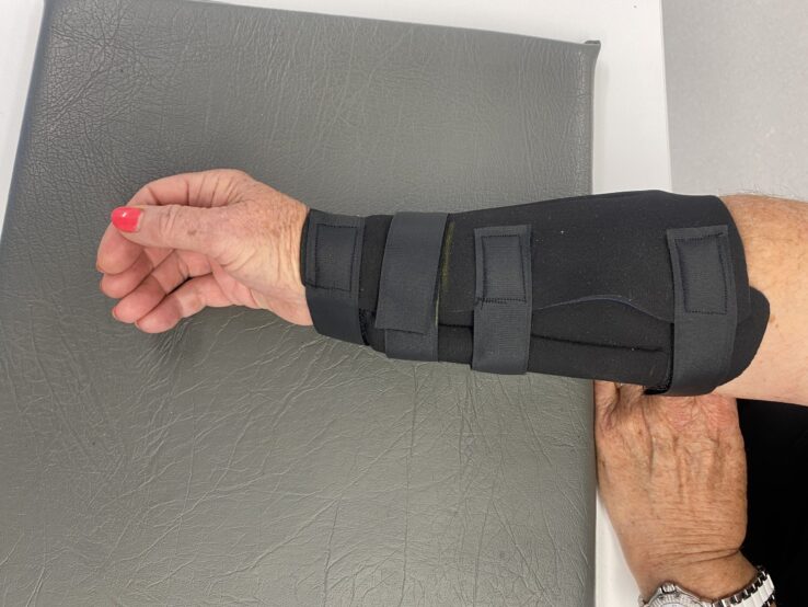 A New Approach: Forearm Rotational Support Brace - Conservative ...